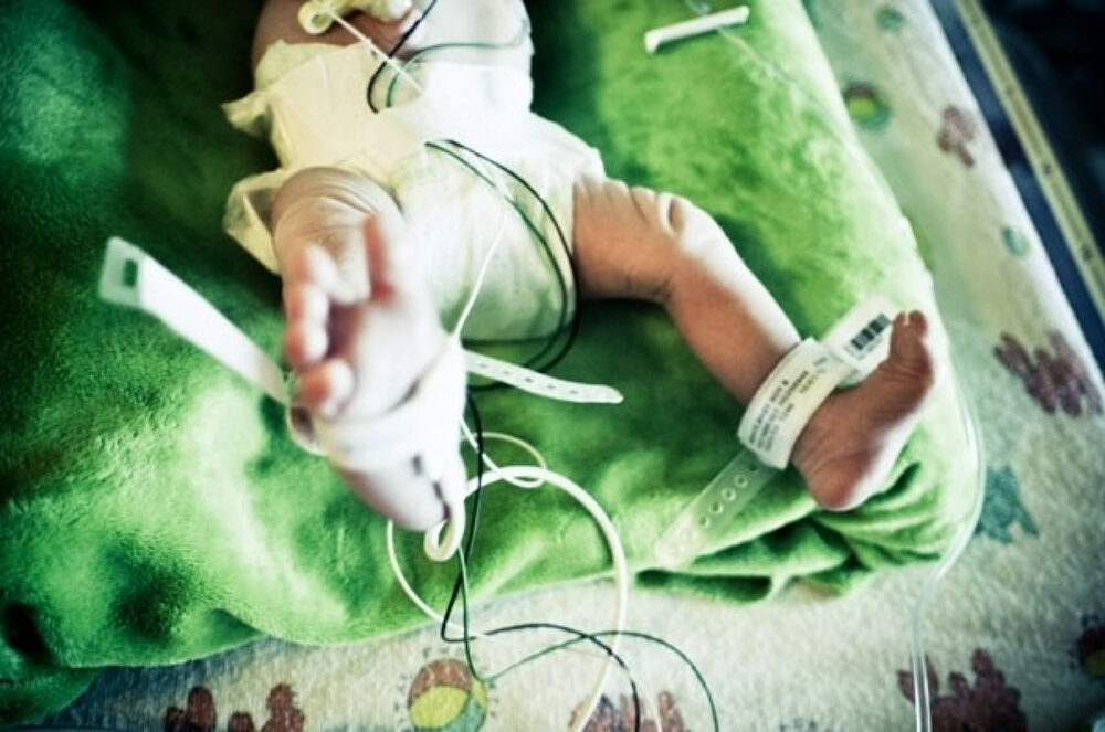 No One Talks About The NICU Postpartum Trauma | Tribeca Therapy